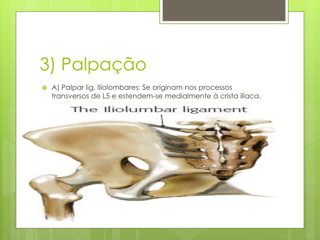 PPT - Exame Físico da articulação S acro-ilíaca PowerPoint Presentation ...