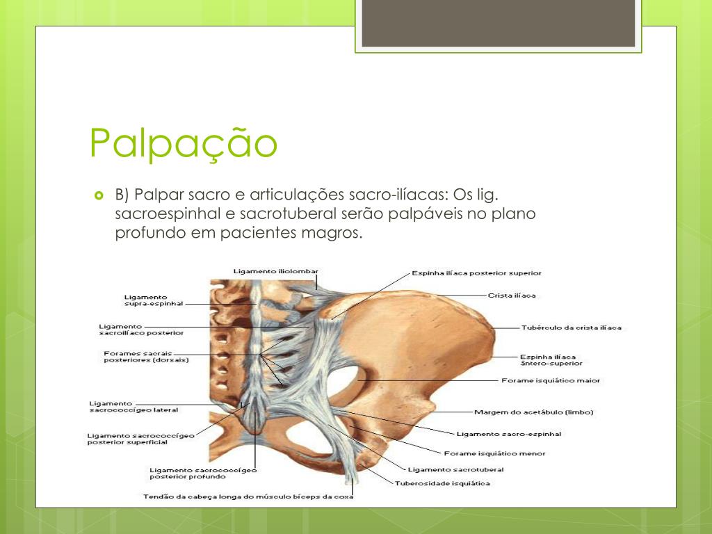 PPT - Exame Físico da articulação S acro-ilíaca PowerPoint Presentation ...