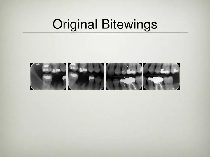PPT - Original Bitewings PowerPoint Presentation, free download - ID ...