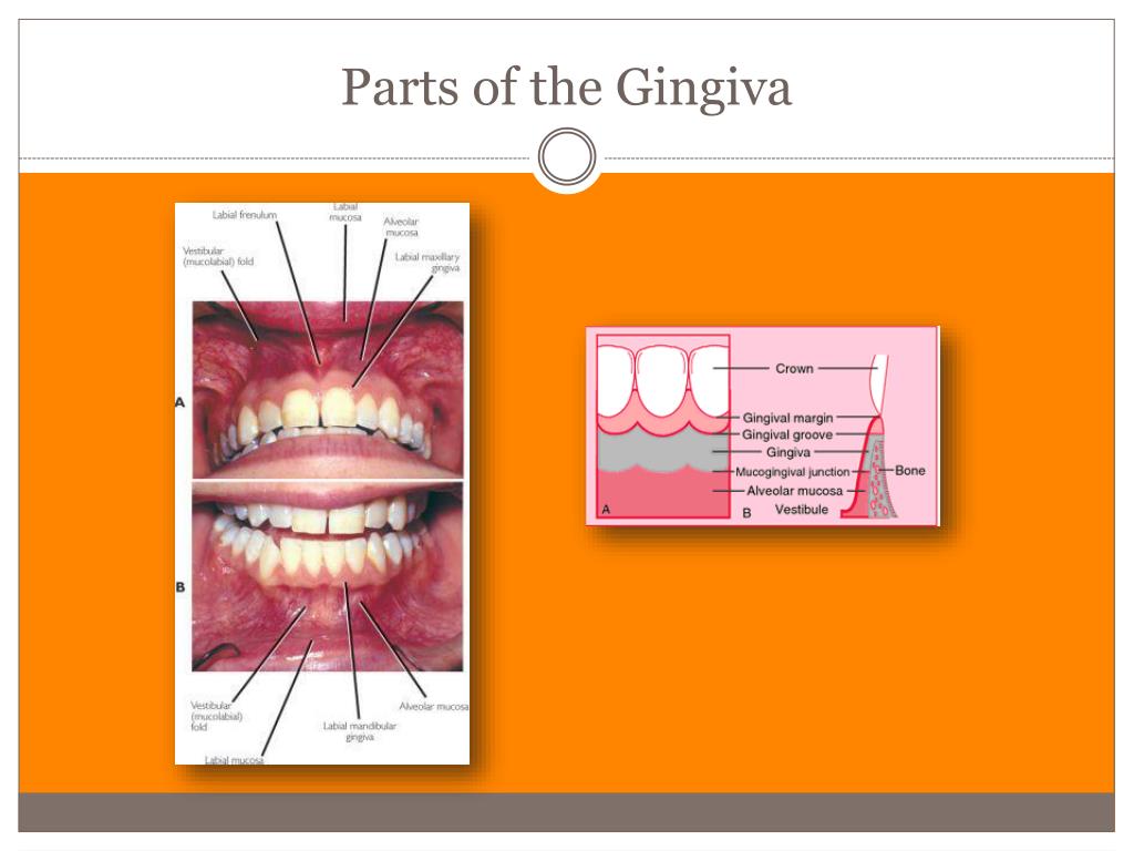 Ppt Periodontics Powerpoint Presentation Free Download Id 2337158