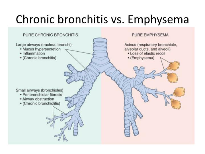 PPT - RESPIRATORY BLOCK PowerPoint Presentation - ID:2337951
