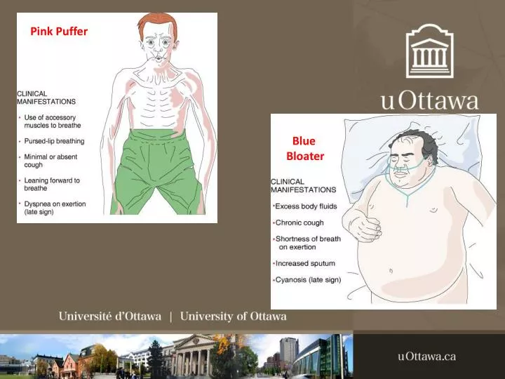 PPT - Pink Puffer PowerPoint Presentation, free download - ID:2338314