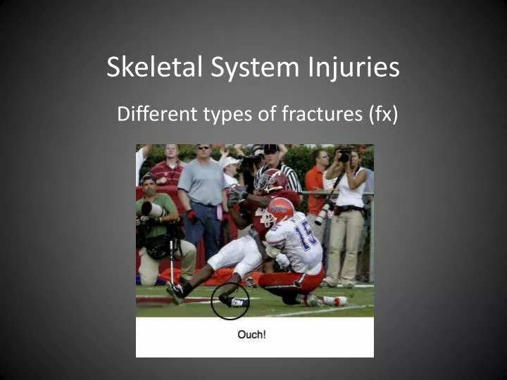 PPT - Skeletal System Injuries PowerPoint Presentation, free download ...