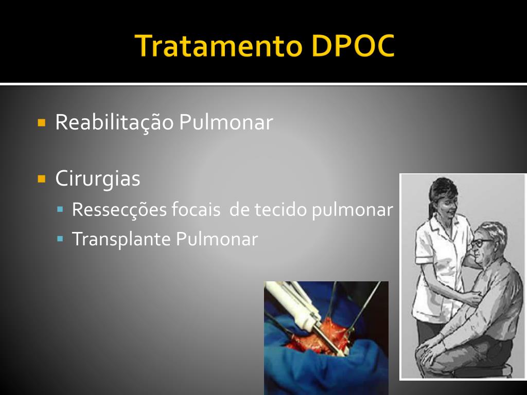 PPT - DOENÇA PULMONAR OBSTRUTIVA CRÔNICA DPOC PowerPoint Presentation ...