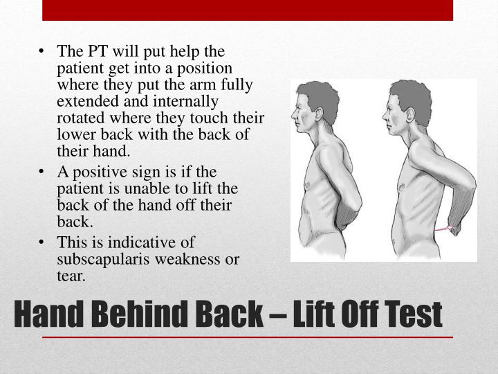PPT - Rotator Cuff Tear Algorithm PowerPoint Presentation - ID:2340403