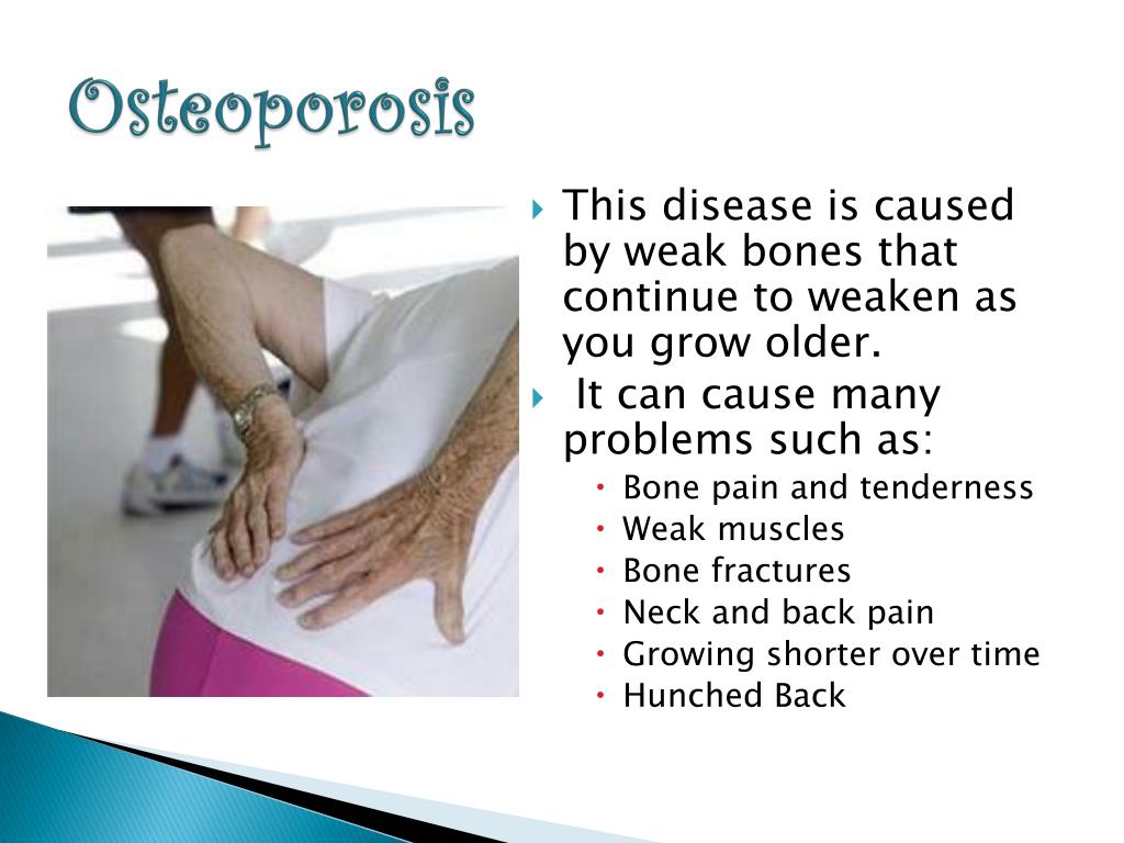 PPT - Girl’s Health Focus: Calcium and Bone Health PowerPoint ...
