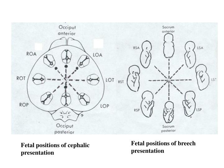 PPT - Normal and abnormal labor PowerPoint Presentation - ID:2343364