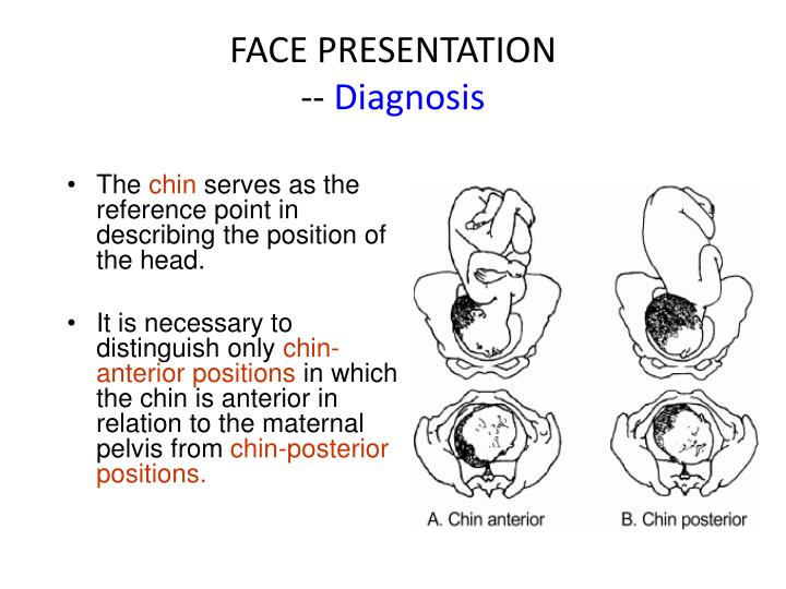 PPT - Malpresentation Malposition PowerPoint Presentation - ID:2343401