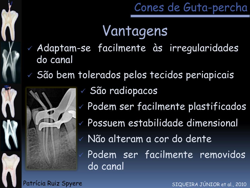PPT - Obturação do Sistema de Canais Radiculares PowerPoint ...