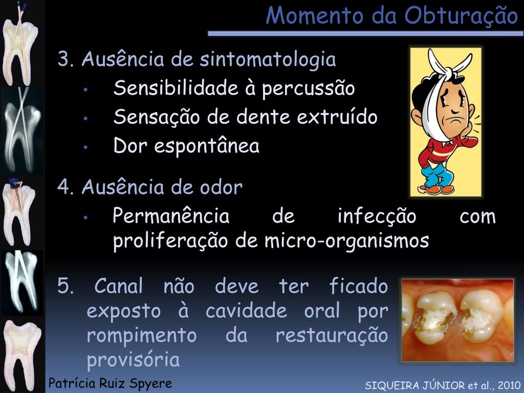 PPT - Obturação do Sistema de Canais Radiculares PowerPoint ...