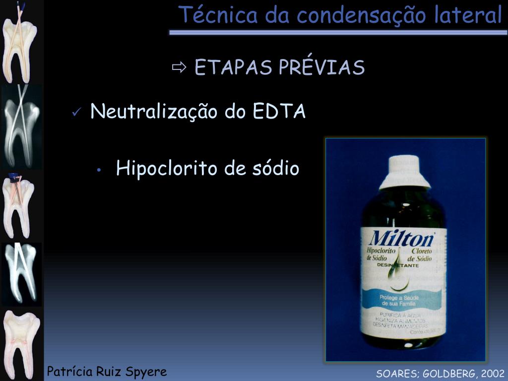 PPT - Obturação do Sistema de Canais Radiculares PowerPoint ...