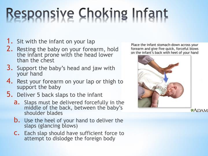 PPT - Choking (FBAO) PowerPoint Presentation - ID:2346016