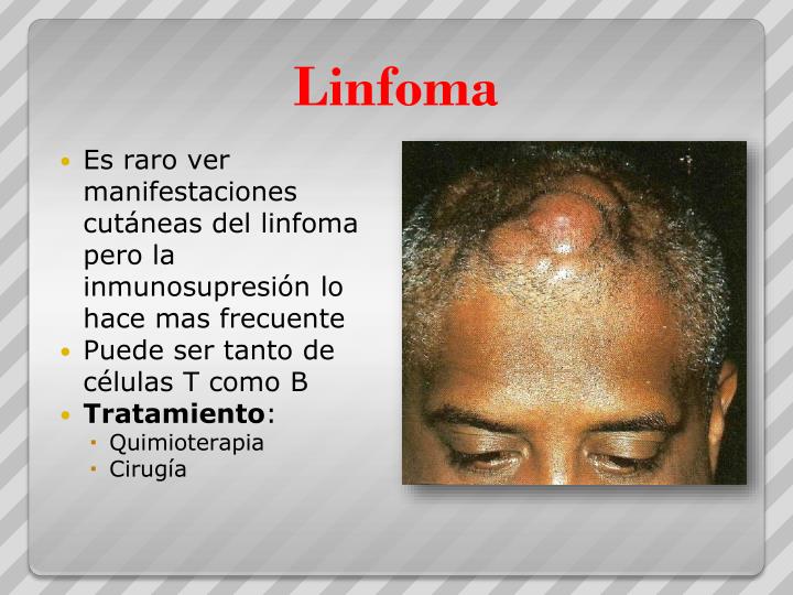 PPT - Manifestaciones cutáneas en el SIDA PowerPoint Presentation - ID ...