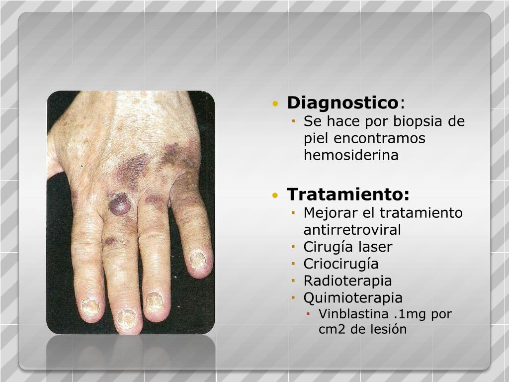 PPT - Manifestaciones cutáneas en el SIDA PowerPoint Presentation, free ...