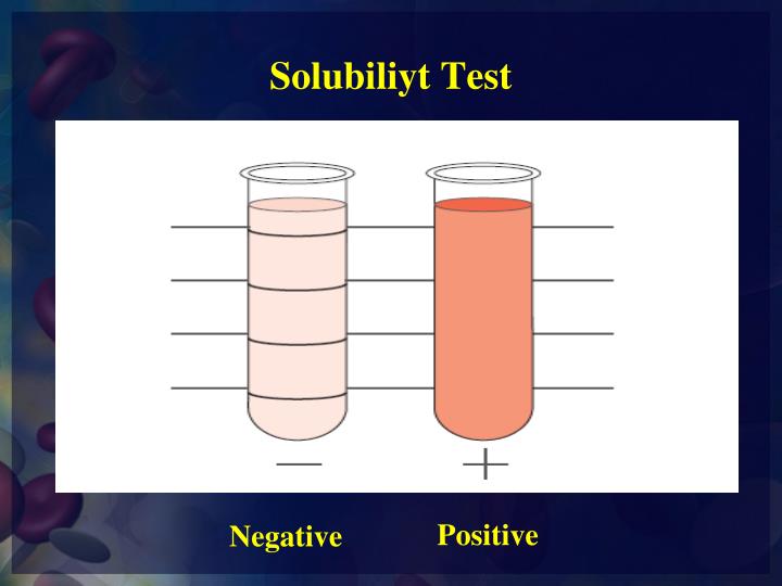 PPT - Sickle Cell PowerPoint Presentation - ID:2347744