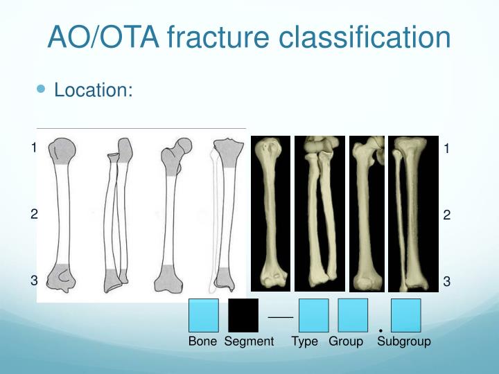 PPT - Principles of Fractures & Fracture Management PowerPoint ...