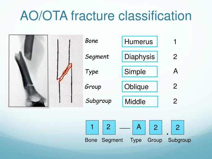 PPT - Principles of Fractures & Fracture Management PowerPoint ...