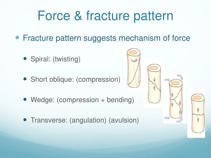 PPT - Principles of Fractures & Fracture Management PowerPoint ...