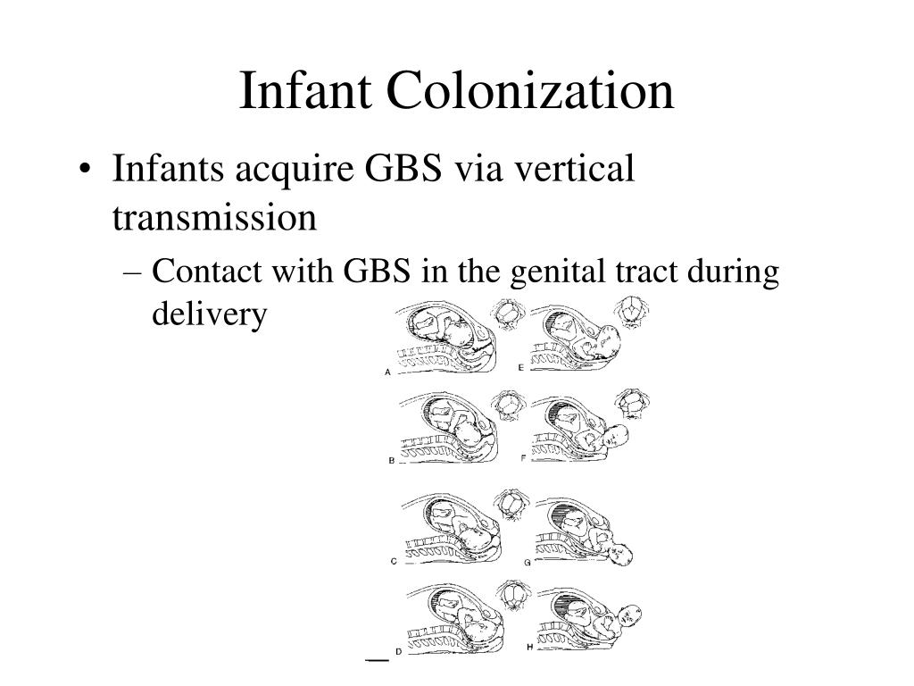 PPT - Group B Streptococci A Newborn’s Greatest Threat? PowerPoint ...