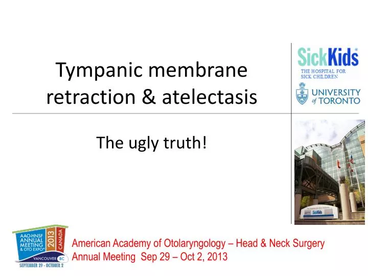PPT - Tympanic membrane retraction & atelectasis PowerPoint ...