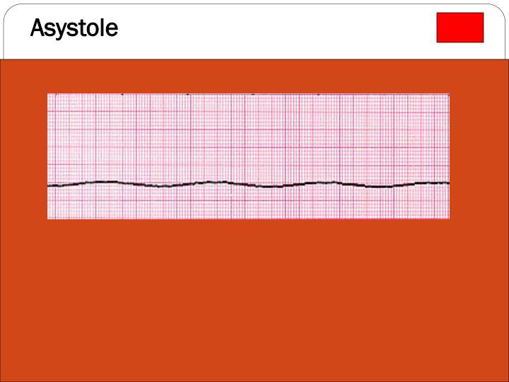 PPT - Cardiovascular--- EKG’s / Cardiac Monitoring PowerPoint ...