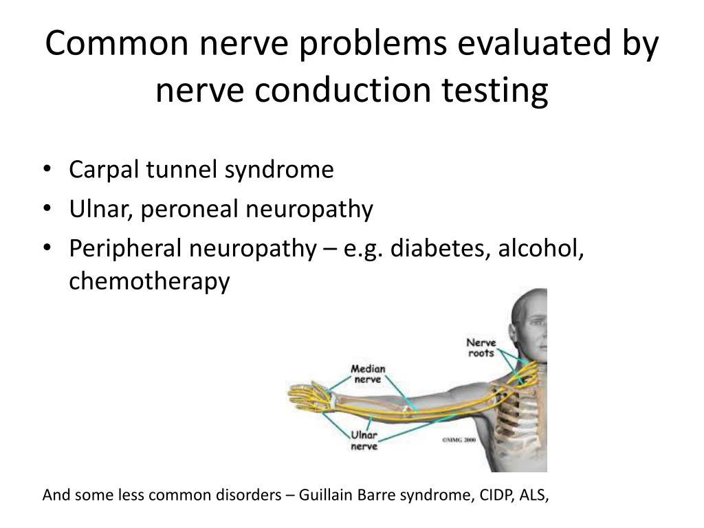 PPT - Rob Rubenstein MD Neurologist - The Doctors Clinic PowerPoint ...