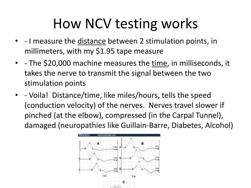 PPT - Rob Rubenstein MD Neurologist - The Doctors Clinic PowerPoint ...
