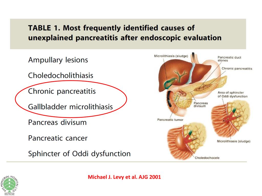 PPT - Recurrent Acute Pancreatitis with Normal LFT, USG & CECT ...