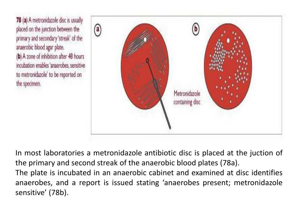 PPT - ENTEROBACTERIACEAE ( Klebsiella , Salmonella, Shigella ...