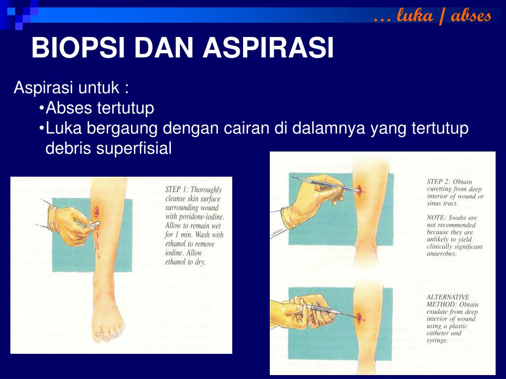 PPT - PENGELOLAAN SPESIMEN UNTUK PEMERIKSAAN MIKROBIOLOGI PowerPoint ...