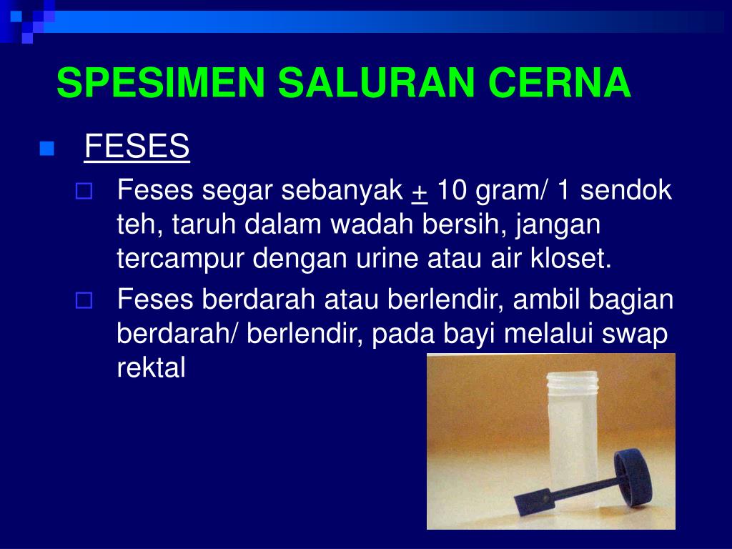 PPT - PENGELOLAAN SPESIMEN UNTUK PEMERIKSAAN MIKROBIOLOGI PowerPoint ...
