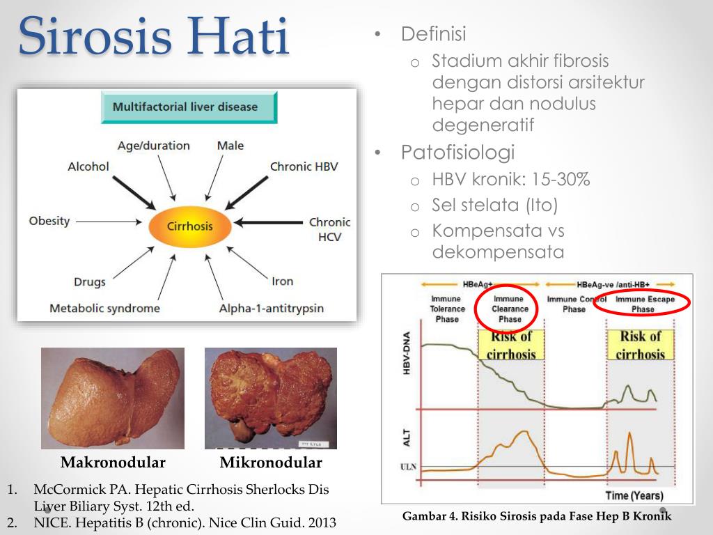 PPT - Presentasi Kasus Perdarahan Saluran Cerna PowerPoint Presentation - ID:2356526