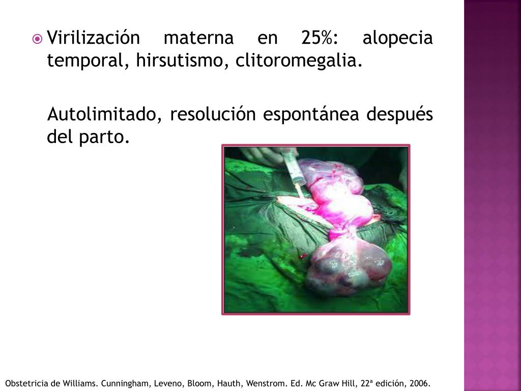 PPT - Cambios maternos durante el embarazo PowerPoint Presentation ...