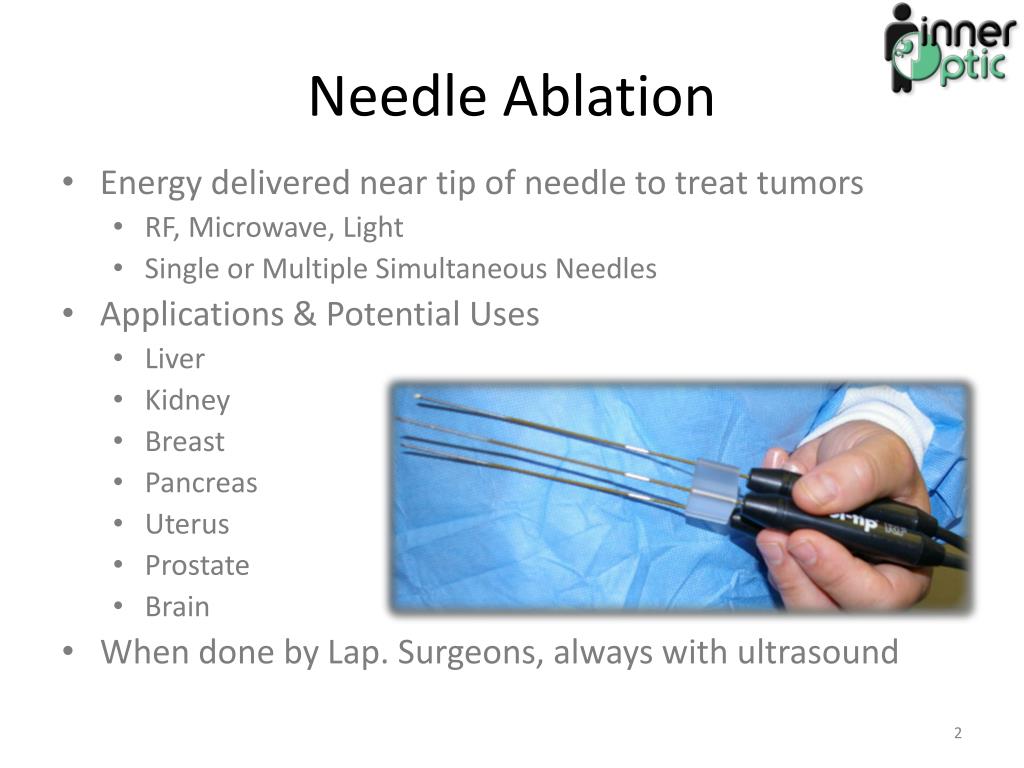 PPT - A im ™: fast & easy 3D ultrasound guidance for surgical needle ...