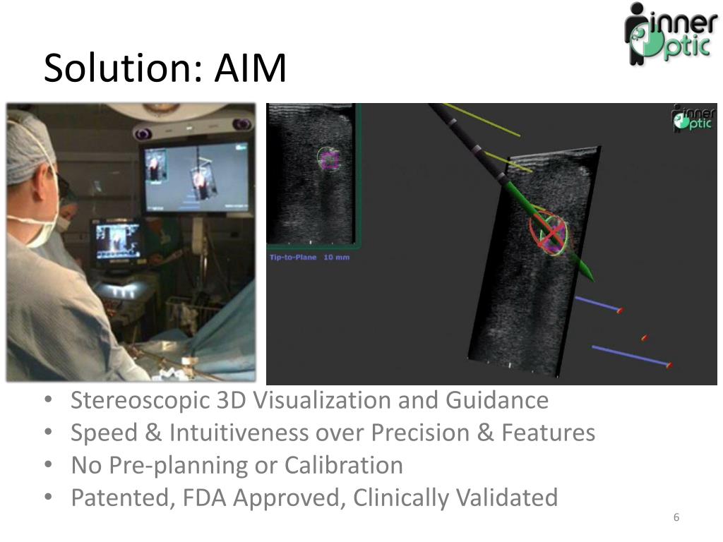 PPT - A im ™: fast & easy 3D ultrasound guidance for surgical needle ...