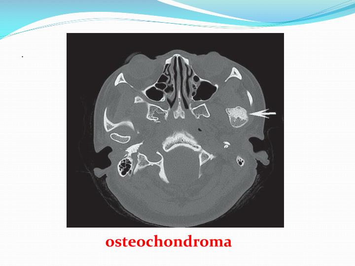 PPT - Diagnostic Imaging of the Temporomandibular Joint PowerPoint ...