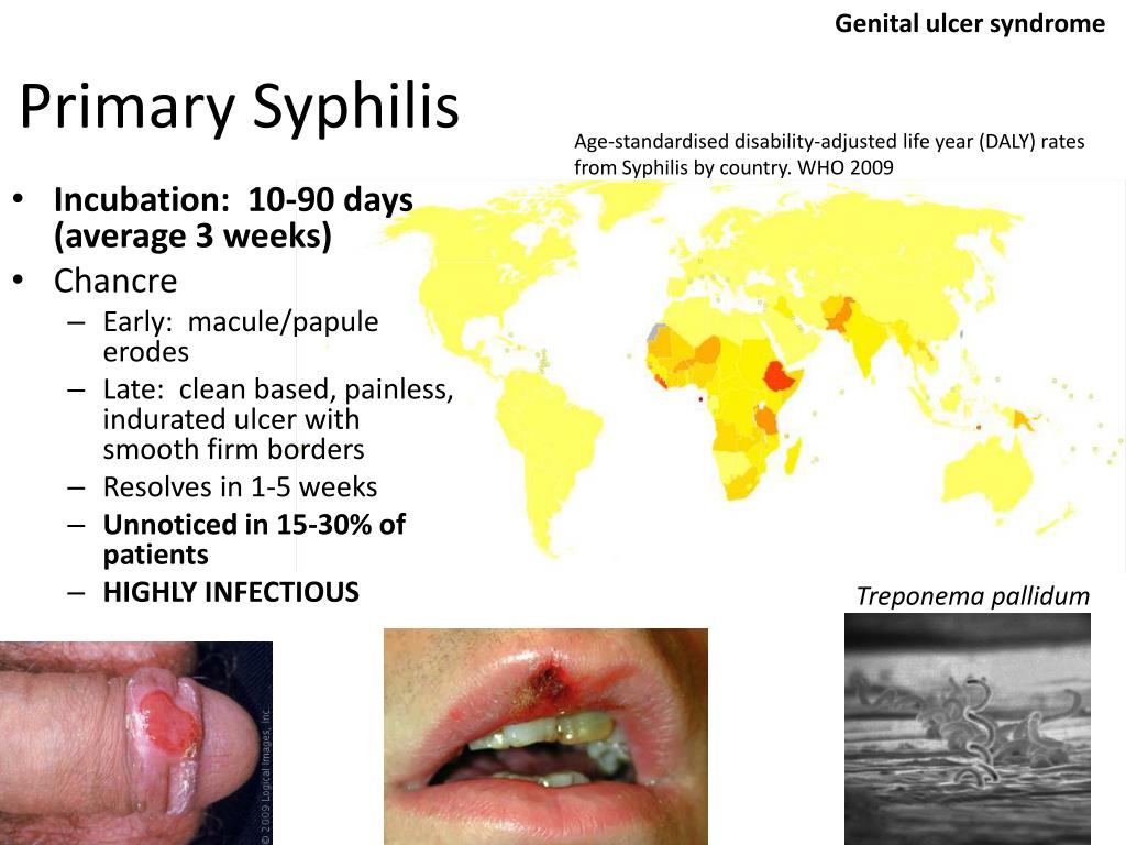 PPT - Sexually Transmitted Diseases and HIV/AIDS PowerPoint ...