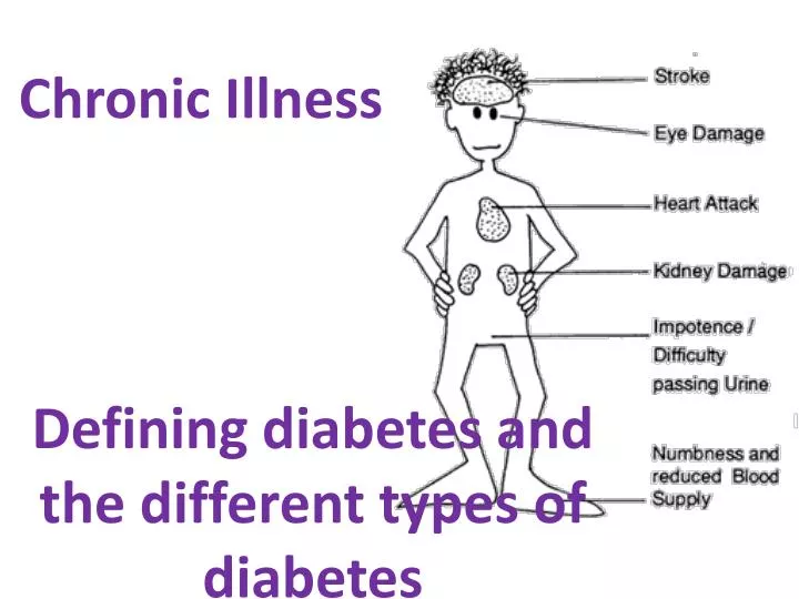 PPT - Chronic Illness PowerPoint Presentation, free download - ID:2358727