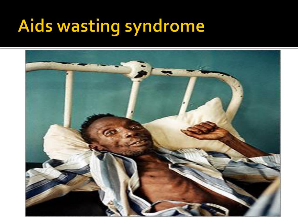 PPT - Human Immunodeficiency Virus & AIDS PowerPoint Presentation - ID ...