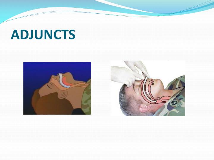 PPT - AIRWAY MANAGEMENT PowerPoint Presentation - ID:2359652