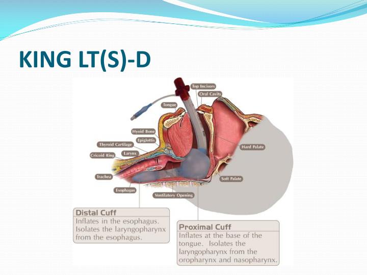 PPT - AIRWAY MANAGEMENT PowerPoint Presentation - ID:2359652