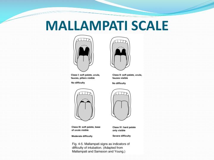 PPT - AIRWAY MANAGEMENT PowerPoint Presentation - ID:2359652