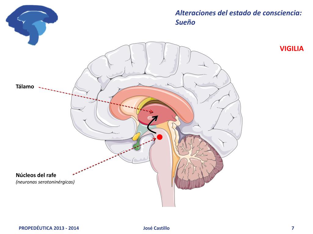PPT - Alteraciones del estado de consciencia. Sueño. Epilepsia. Coma ...