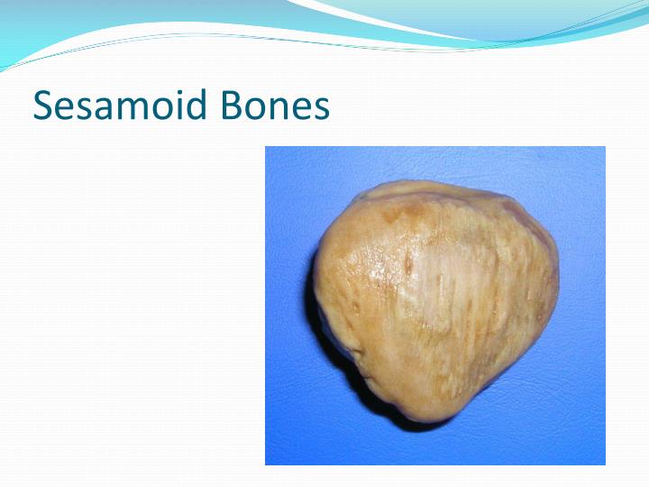 PPT - Osteology PowerPoint Presentation - ID:2360116