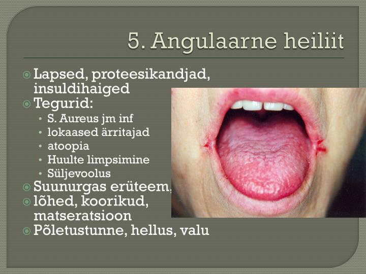 PPT - KANDIDOOS nahal ja suguelunditel PowerPoint Presentation - ID:2360716