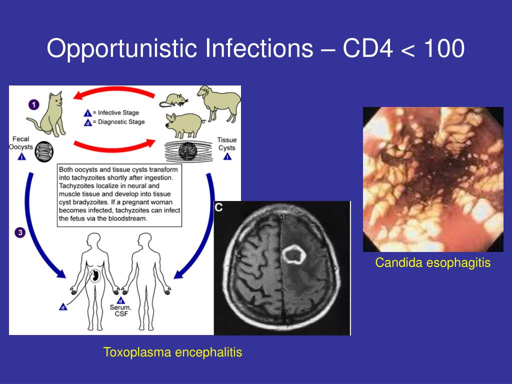 PPT - HIV / AIDS & Opportunistic Infections PowerPoint Presentation ...