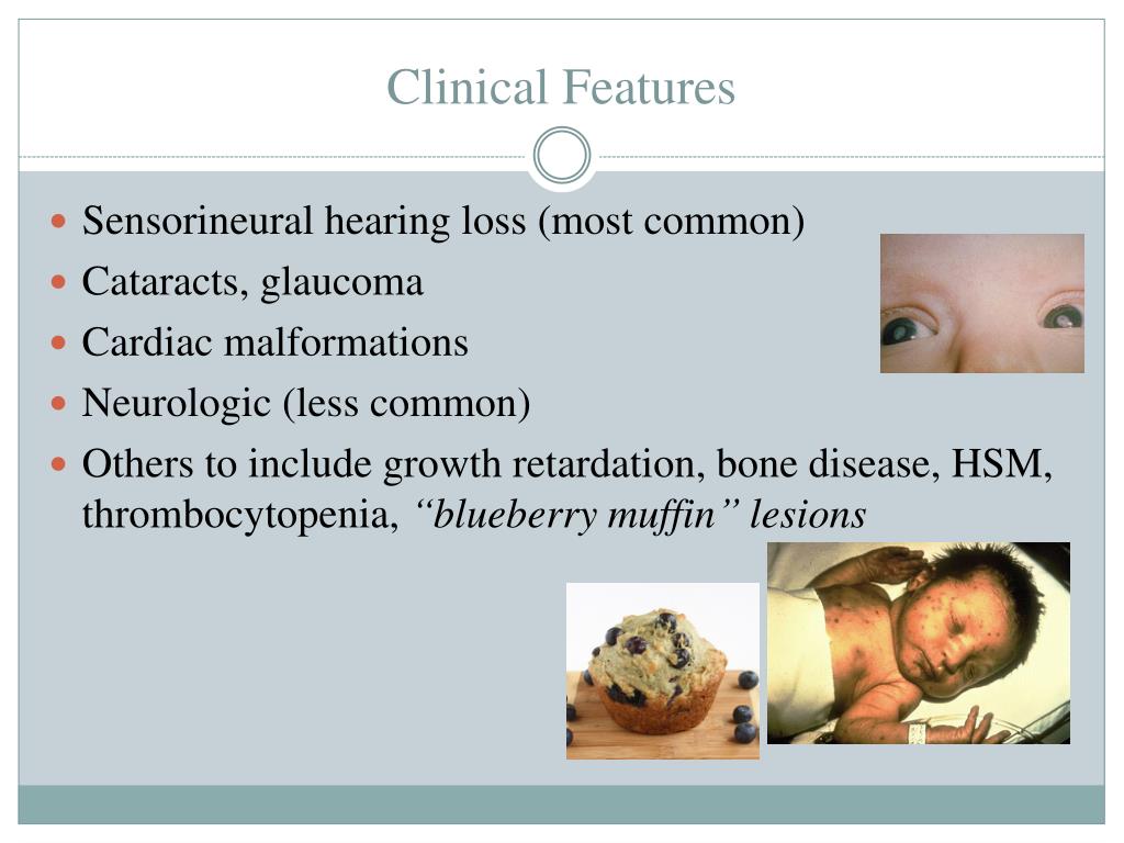 PPT - Transplacental (Congenital) Infection PowerPoint Presentation ...