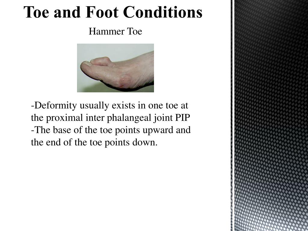 PPT - Anatomy of The Foot & Ankle PowerPoint Presentation, free ...