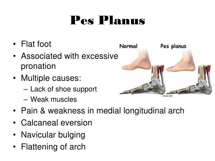 PPT - The Foot PowerPoint Presentation - ID:2361556