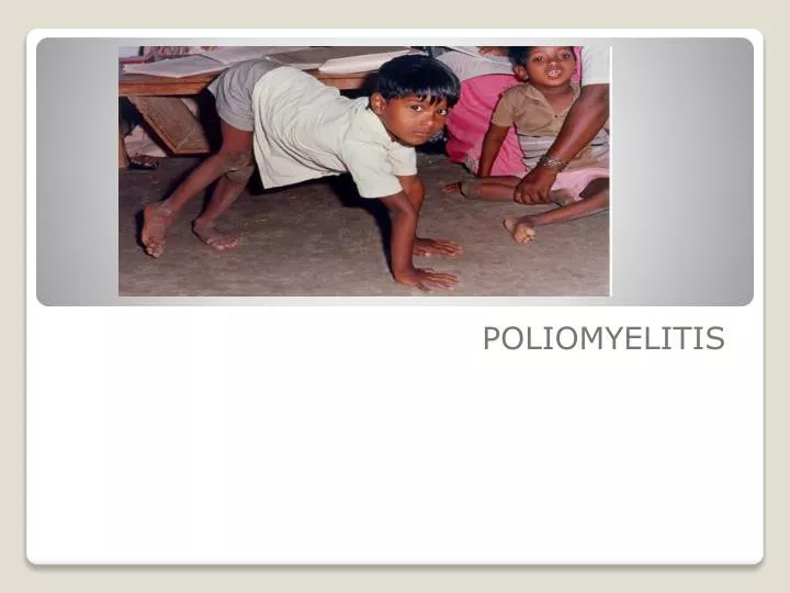 PPT - POLIOMYELITIS PowerPoint Presentation, free download - ID:2361724